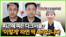 GNG TV 영상 유튜브 - 지앤지병원